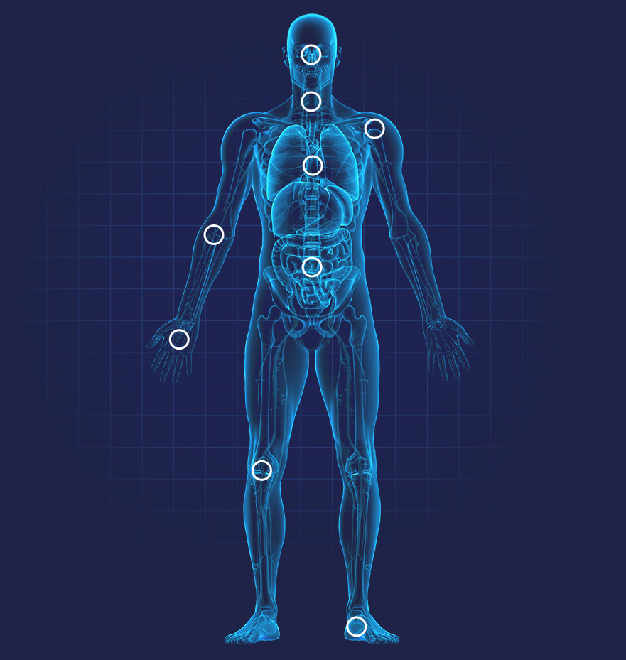 Botox - foundationpainspine
